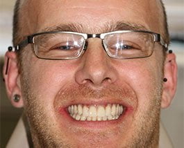 Smile Gallery Leicester | Dentist Wigston | Hallcross Dental